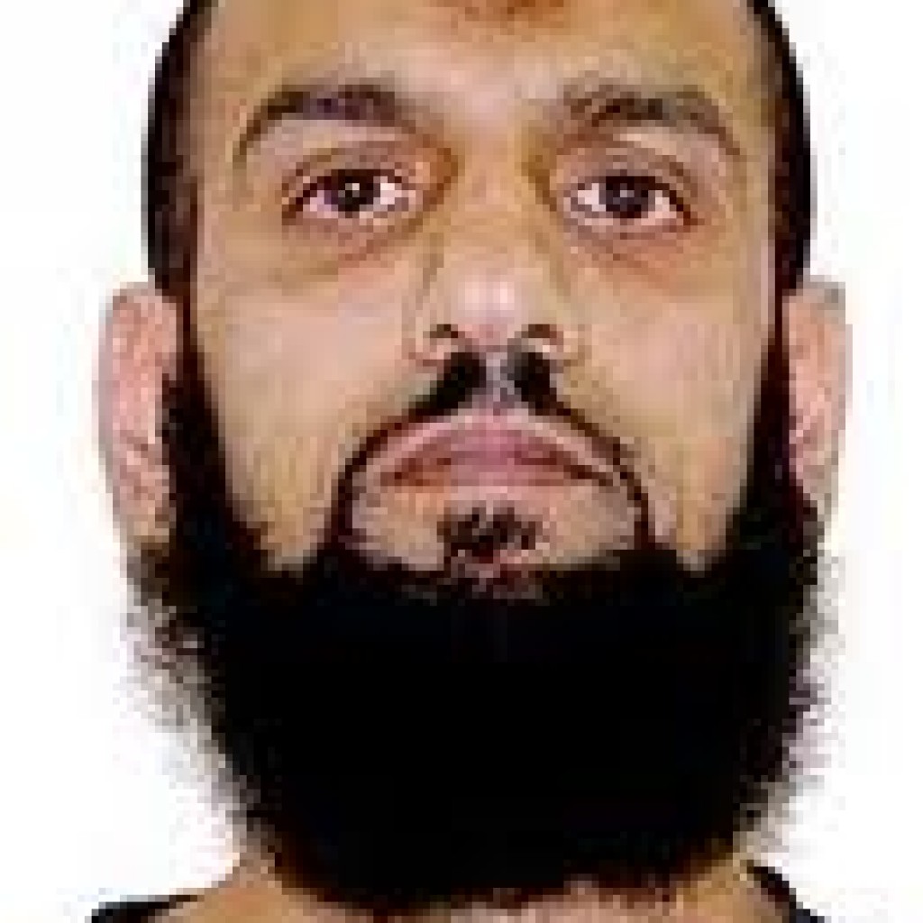 Tanda Hitam di Dahi, Ciri Kesholihan? – Yayasan Baitul Maqdis